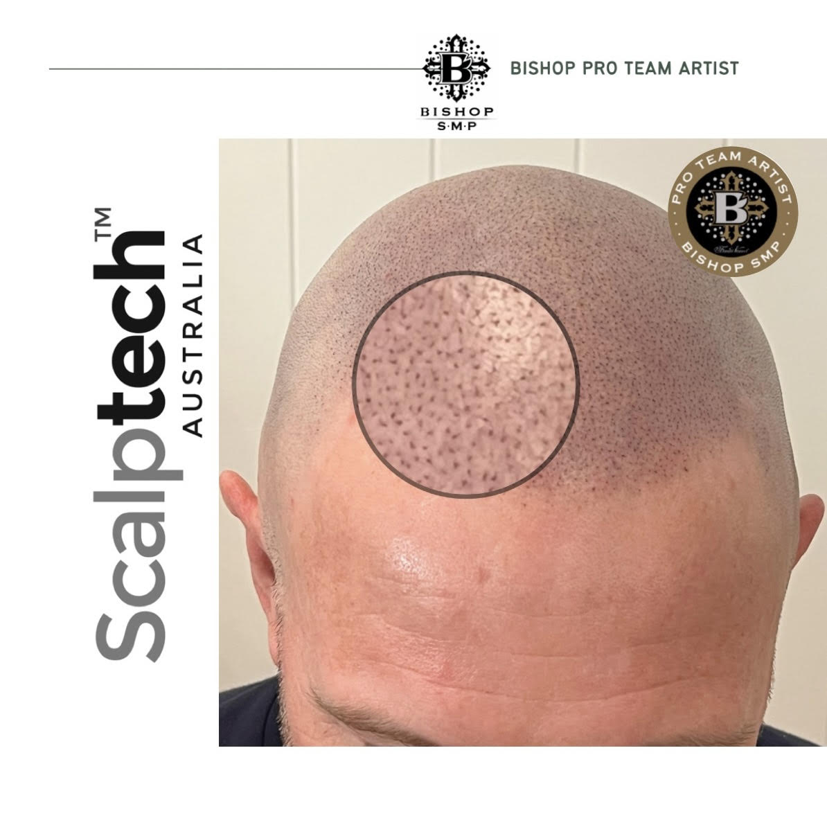 Gallery – Scalp Tech Australia